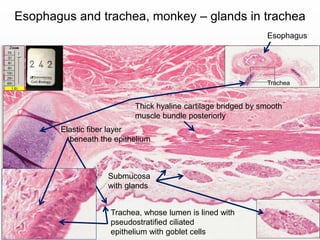 Trachea Histology Labeled Seromucous Glands