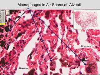Alveolar Macrophage Histology