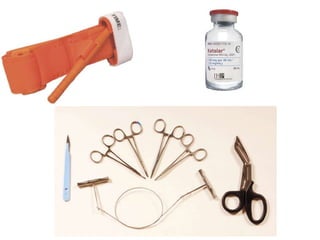 Field amputation | PPTX