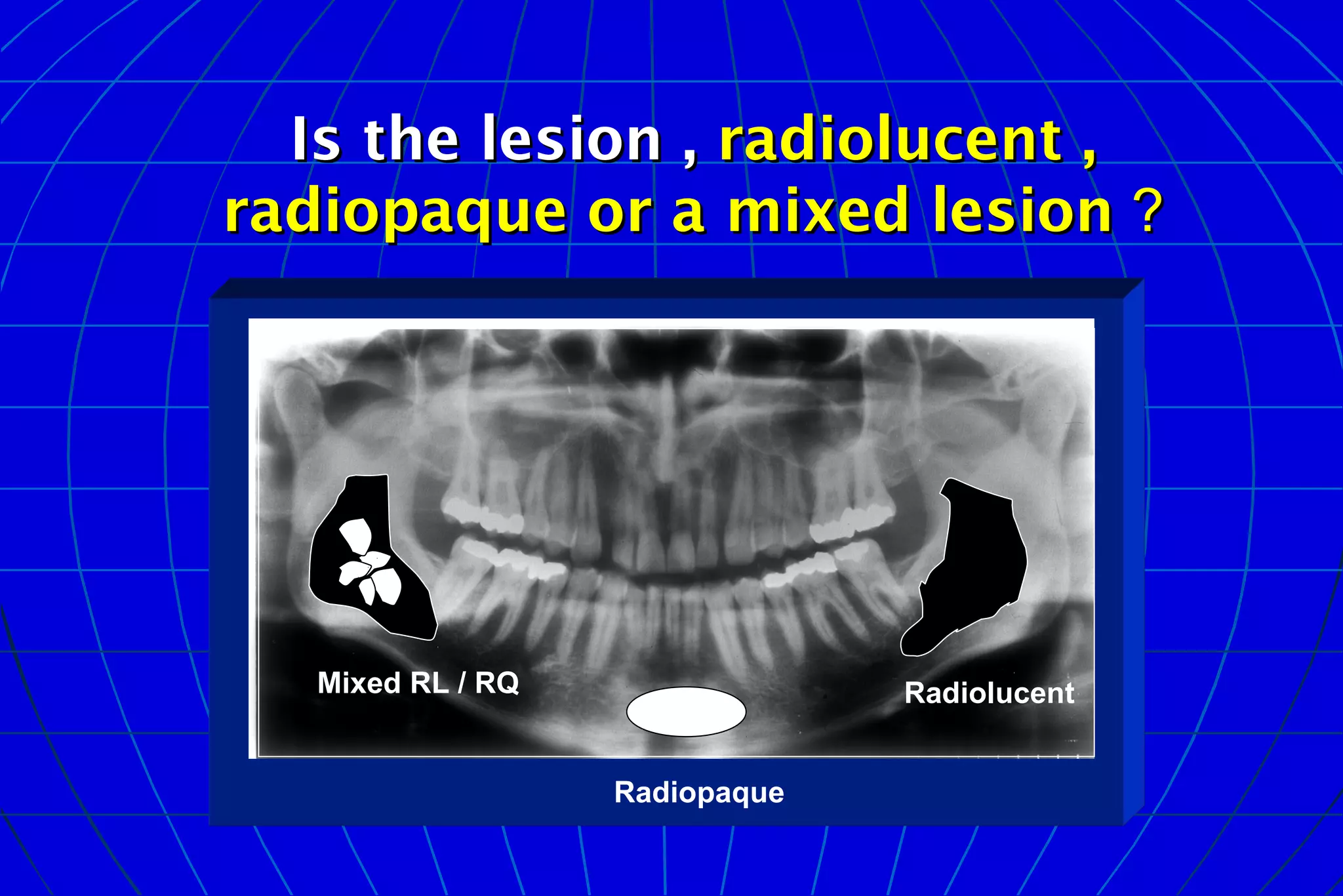 Oral radiology intro differential diagnosis | PPT