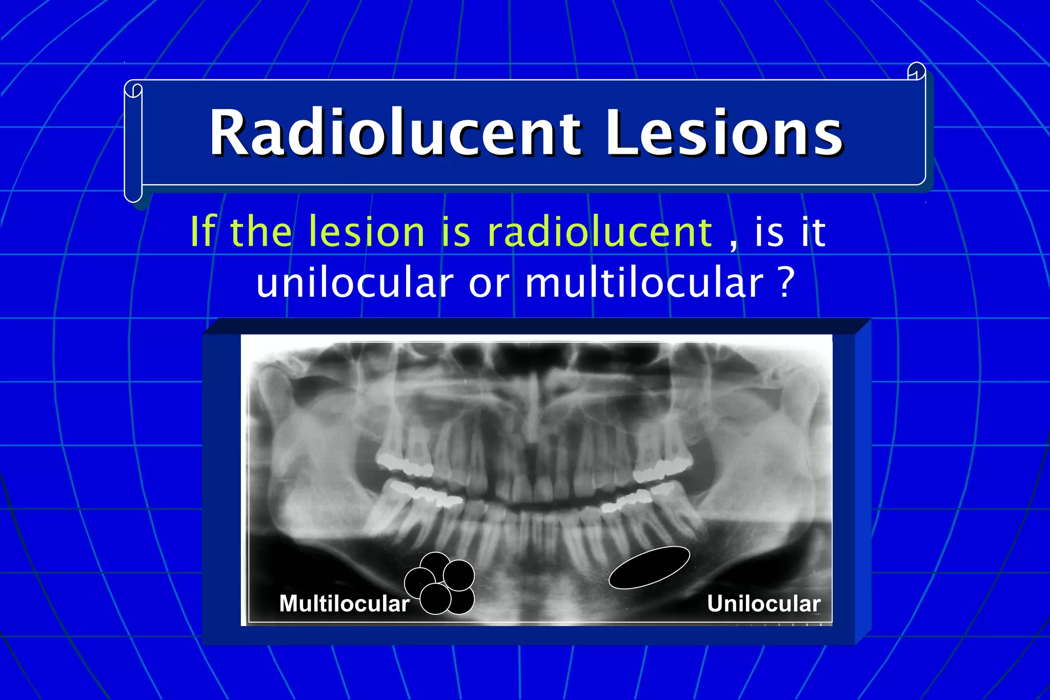 Oral radiology intro differential diagnosis | PPT