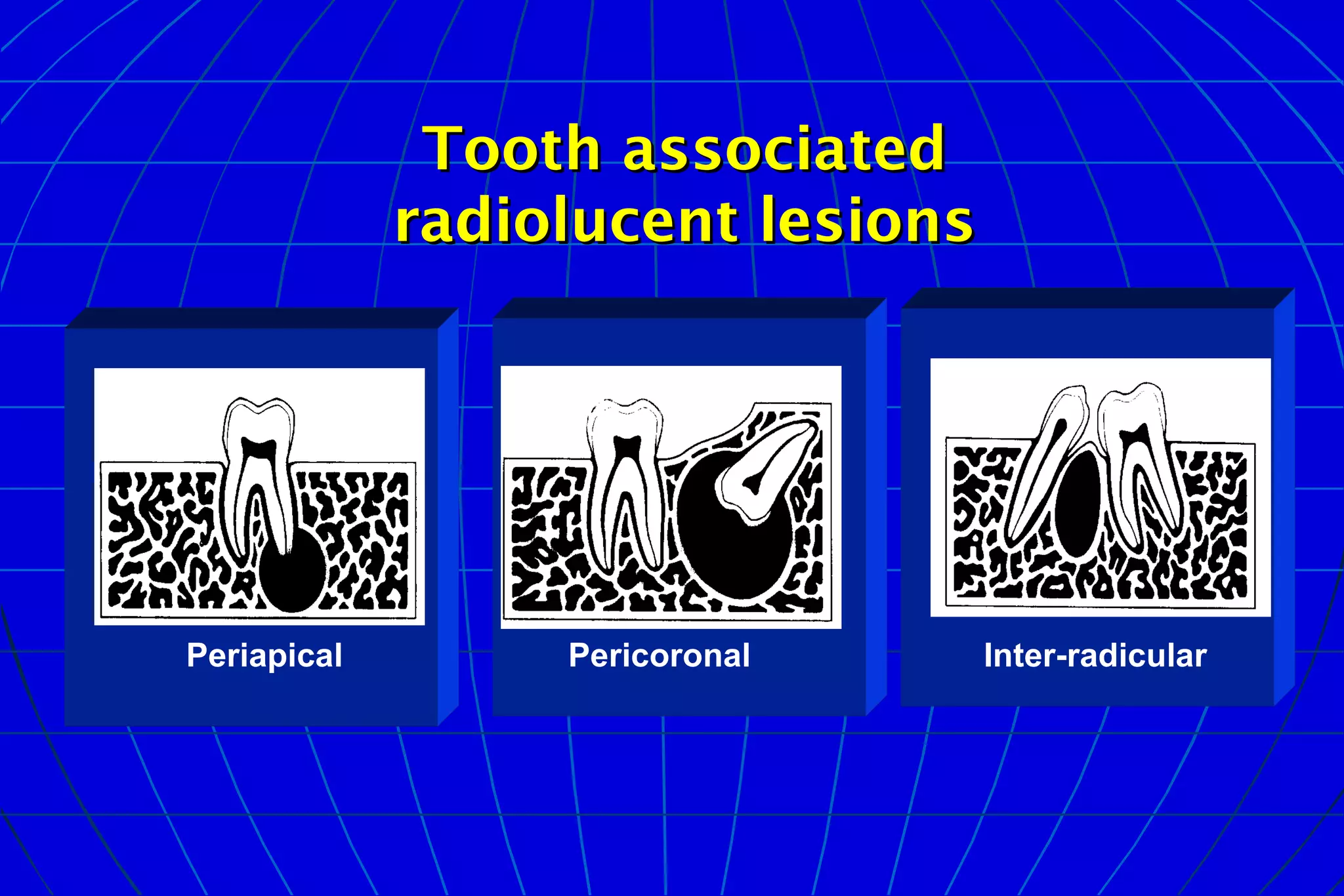 Oral radiology intro differential diagnosis | PPT