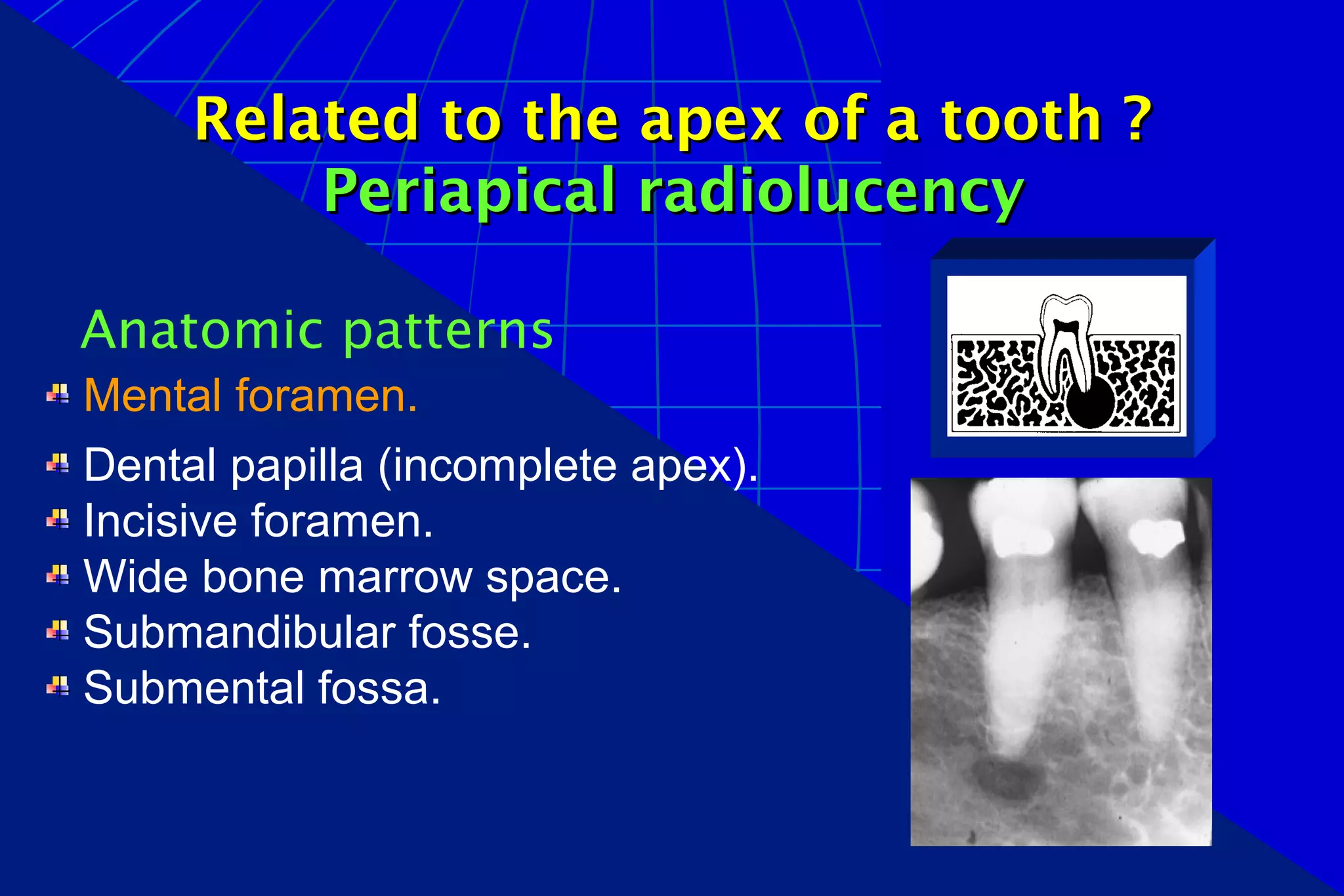 Oral radiology intro differential diagnosis | PPT