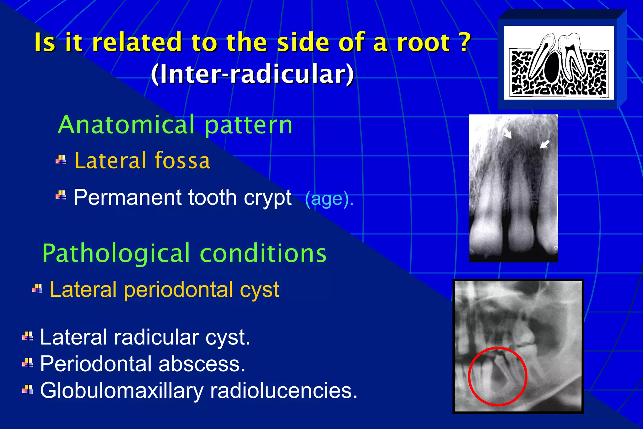 Oral radiology intro differential diagnosis | PPT