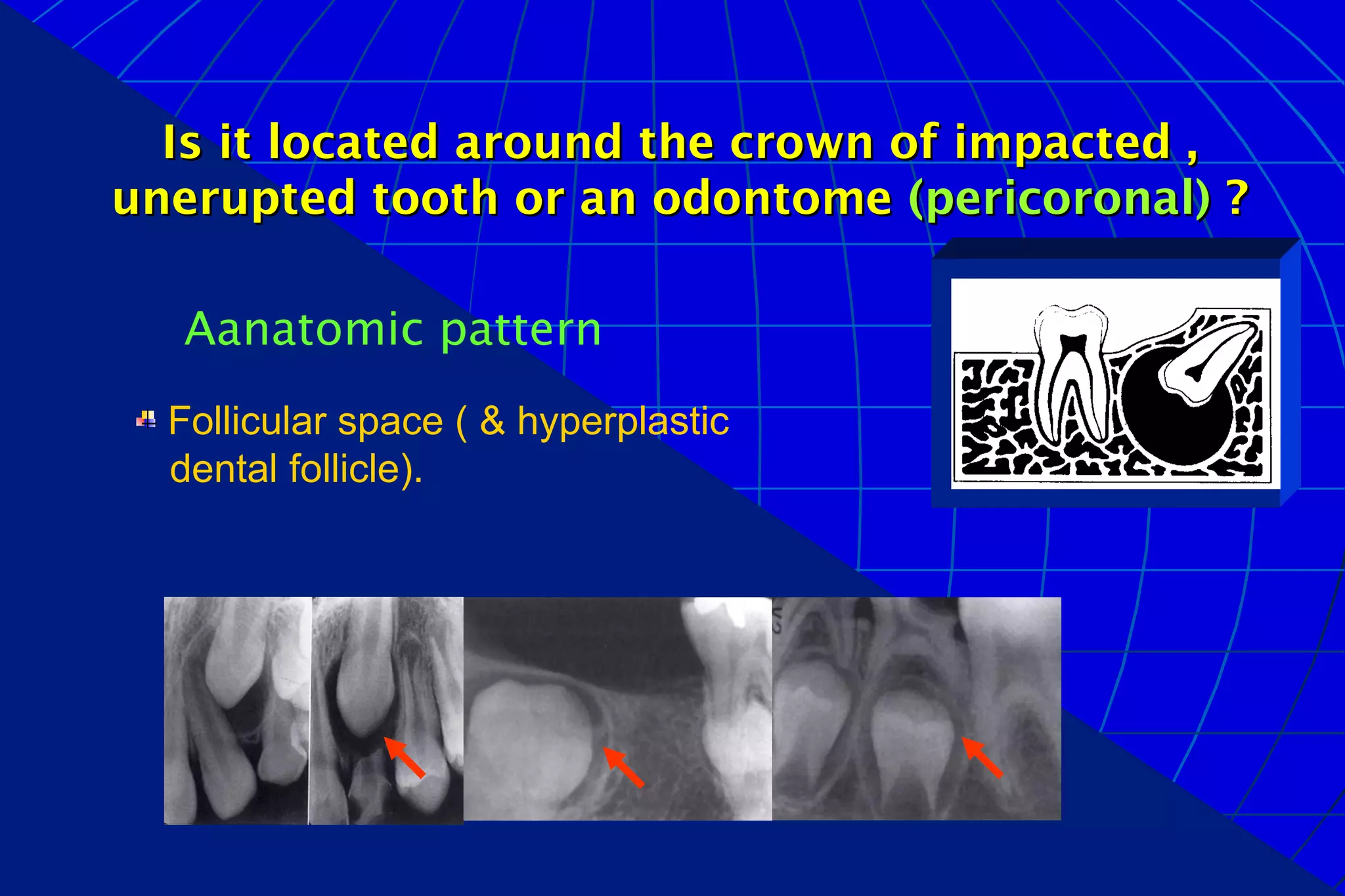 Oral radiology intro differential diagnosis | PPT