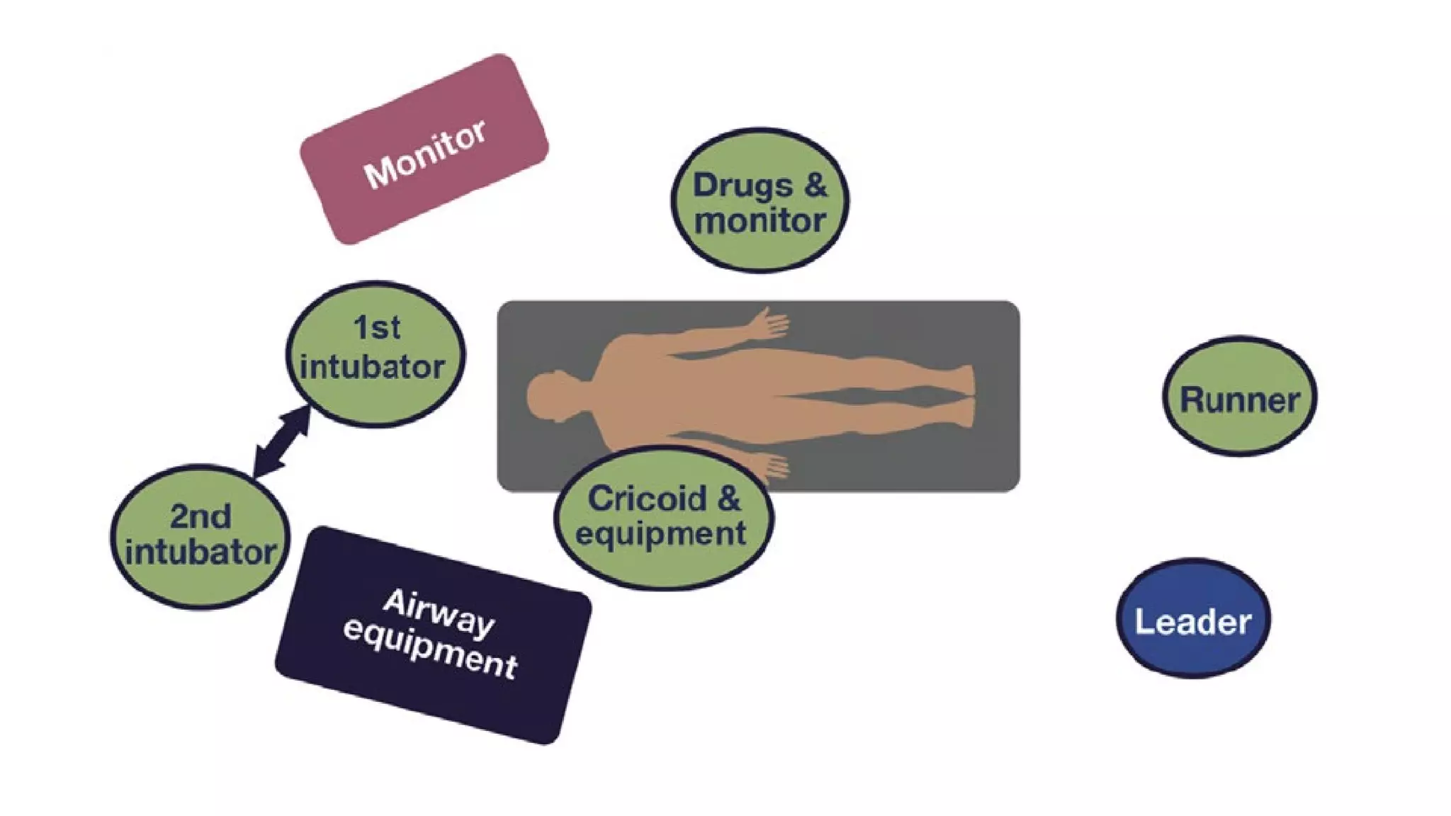 Airway management in Critical Care | PDF
