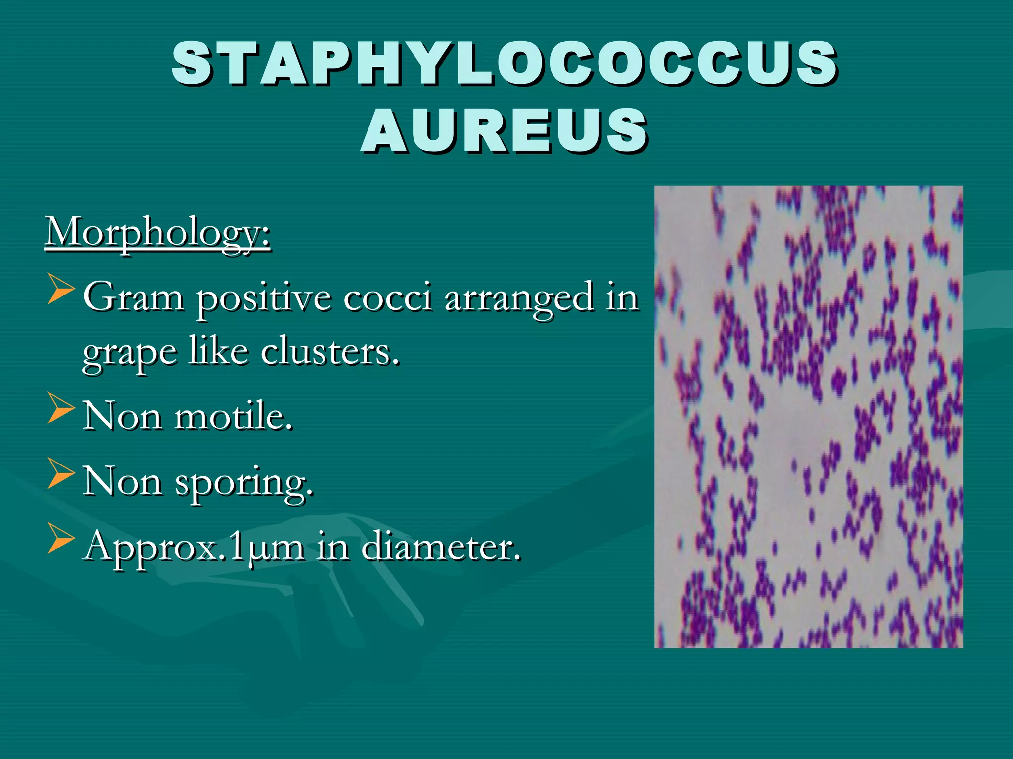 Staphylococcus aureus | PPT