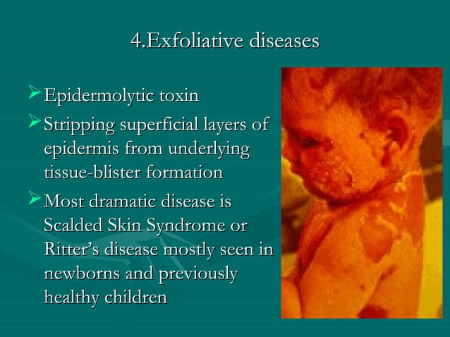 Staphylococcus aureus | PPT