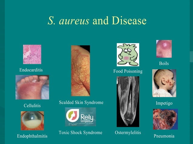 Staphylococcus aureus | PPT