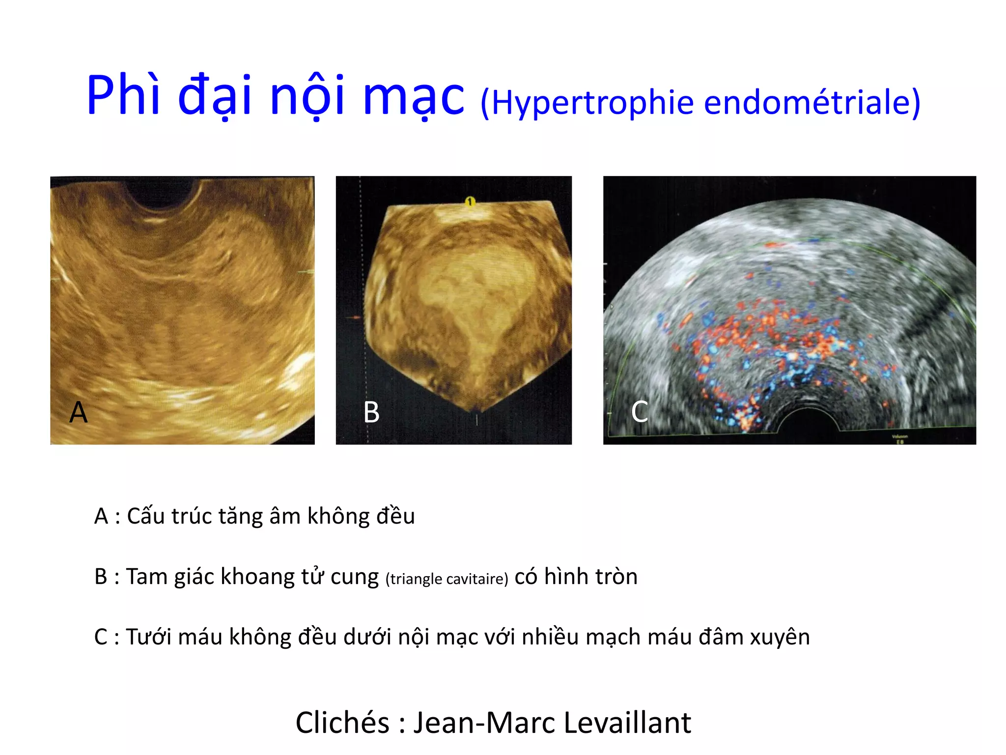 1. Sieu am phu khoa binh thuong, GS Michel Collet | PDF