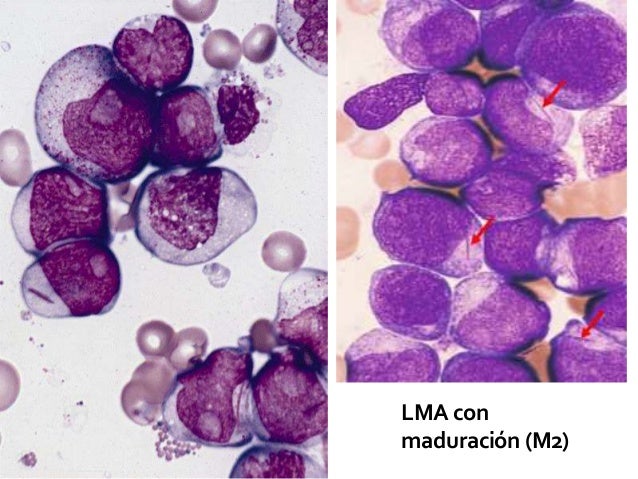 1.LMA (introducción)
