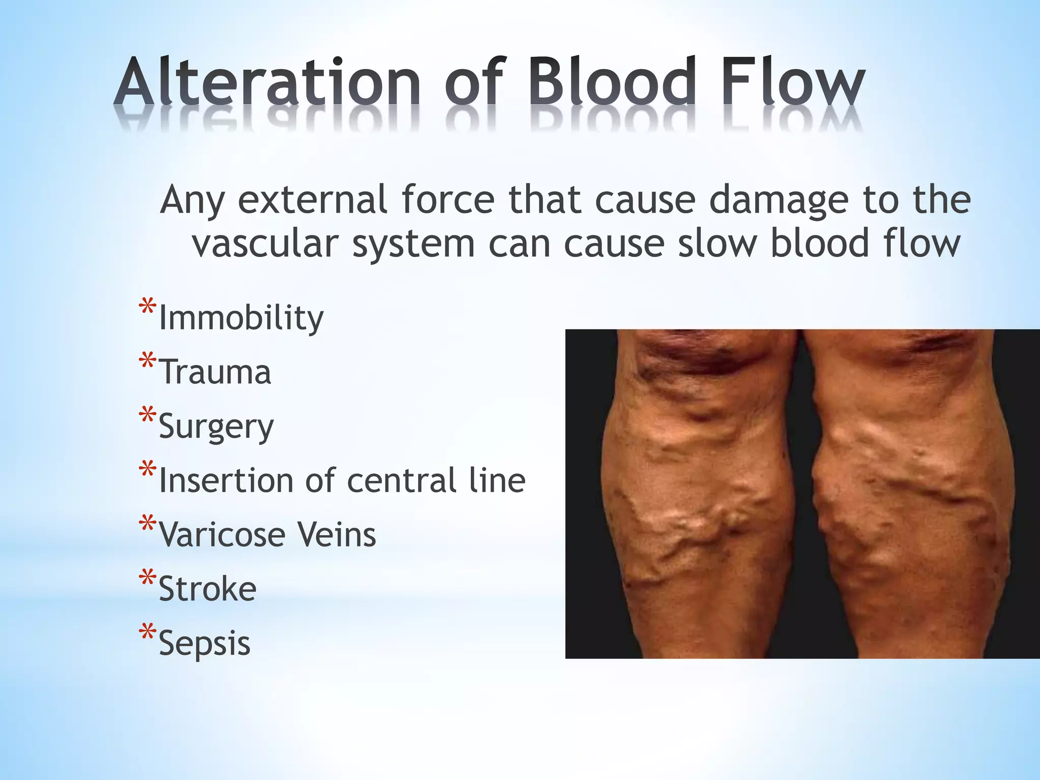 Deep Vein Thrombosis (dvt) by Dr Aftub | PPT