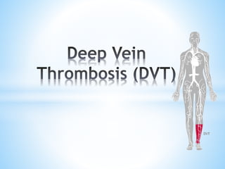 Deep Vein Thrombosis (dvt) by Dr Aftub | PPTX