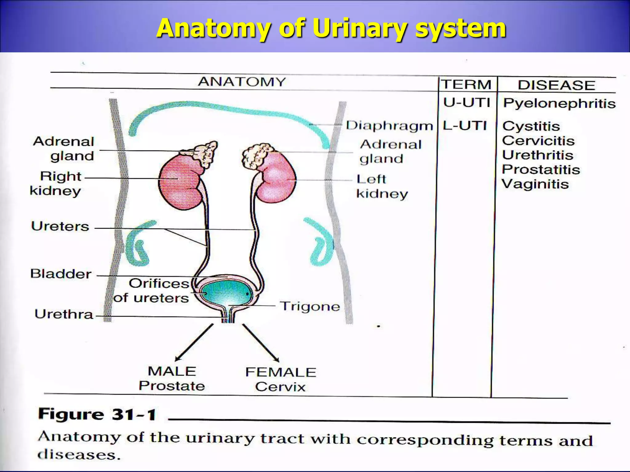 1. urinary tract infection (UTI) | PPT