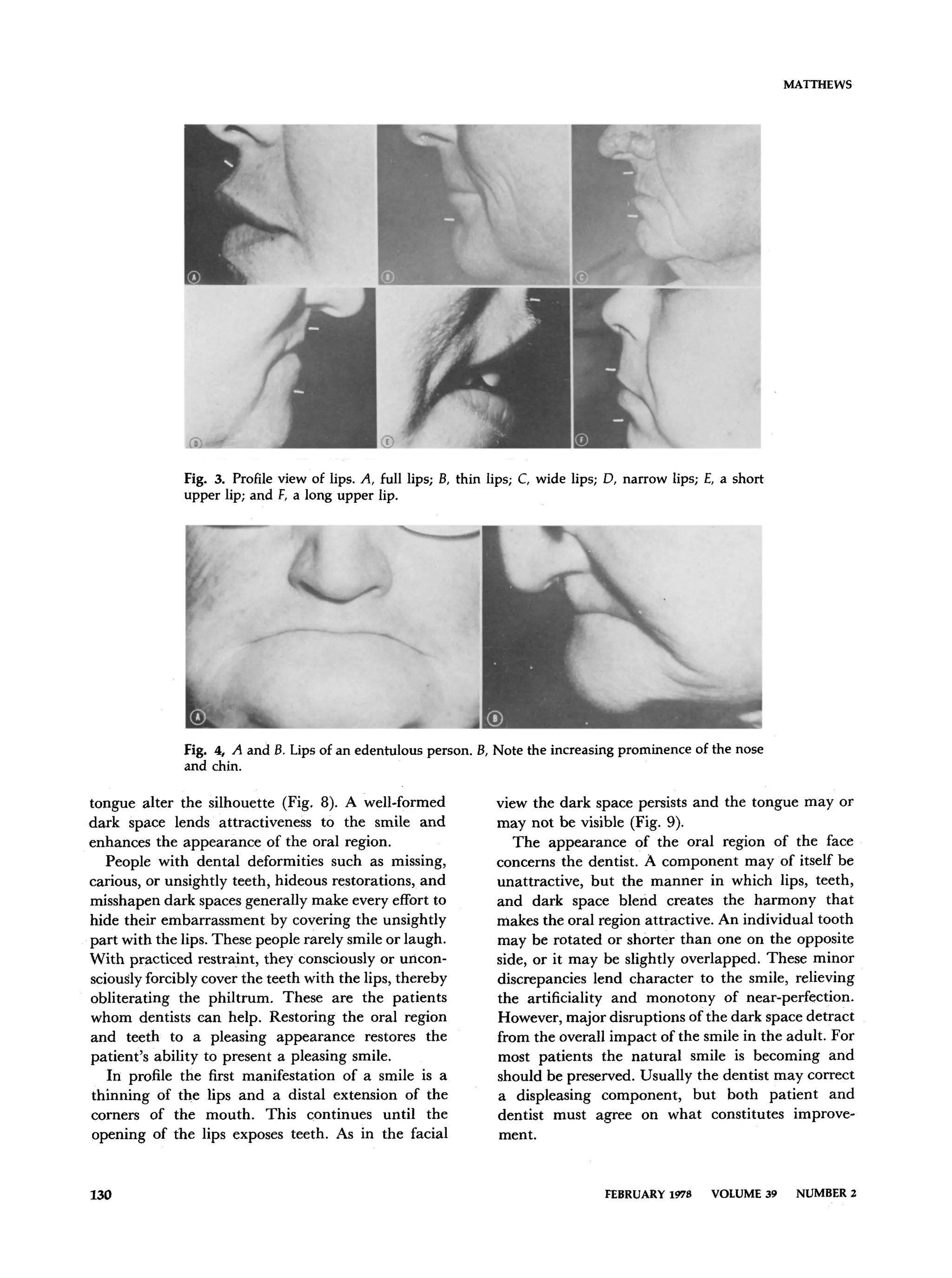 THE ANATOMY OF SMILE | PDF