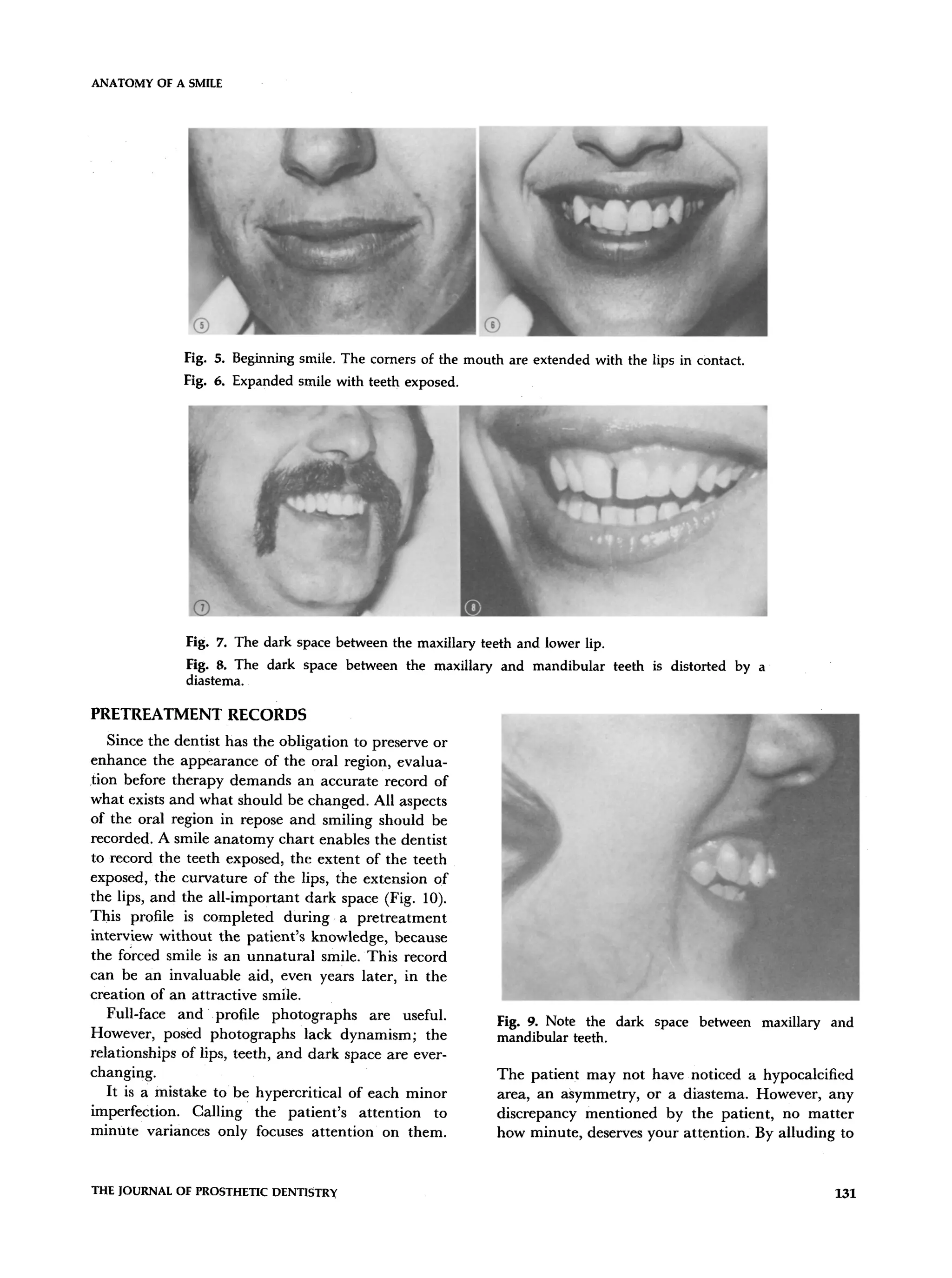 THE ANATOMY OF SMILE | PDF