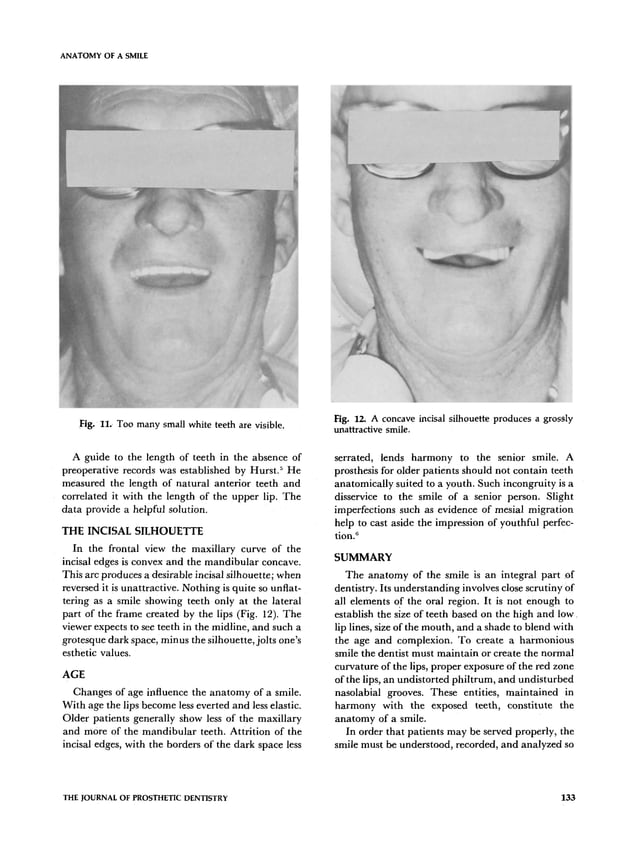 THE ANATOMY OF SMILE | PDF