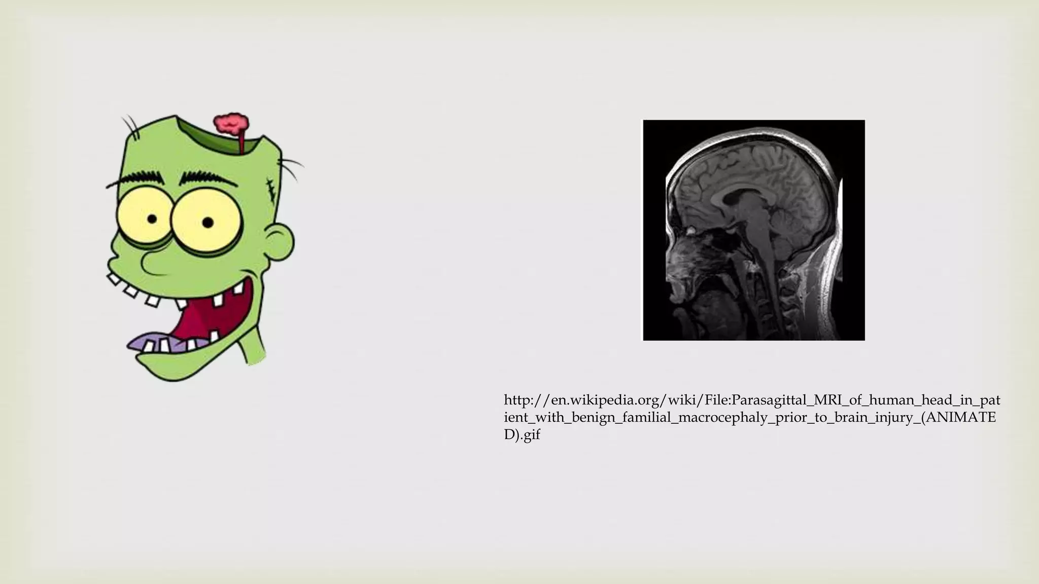 1 1 introduction-to_the_focused_and_diffuse_mode | PPT