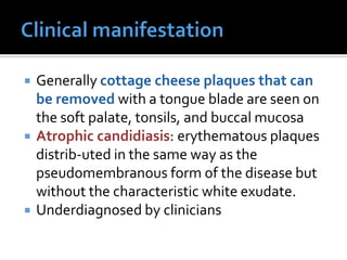 1.1 oral candidiasis | PPTX