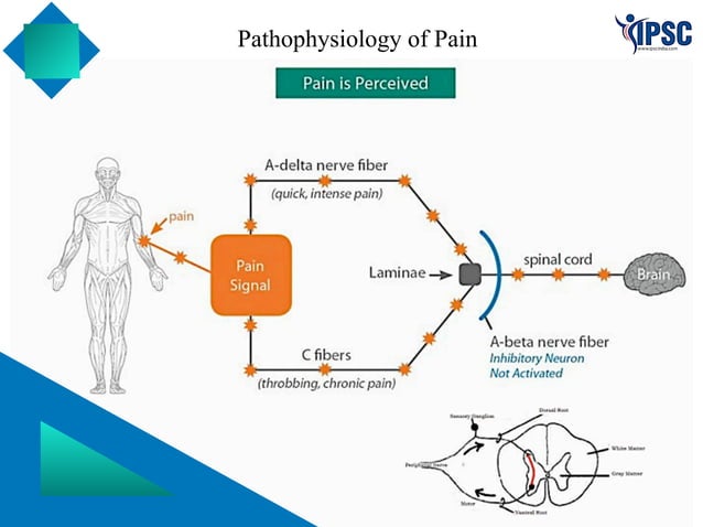 1. introduction to Interventional Pain Management | PDF