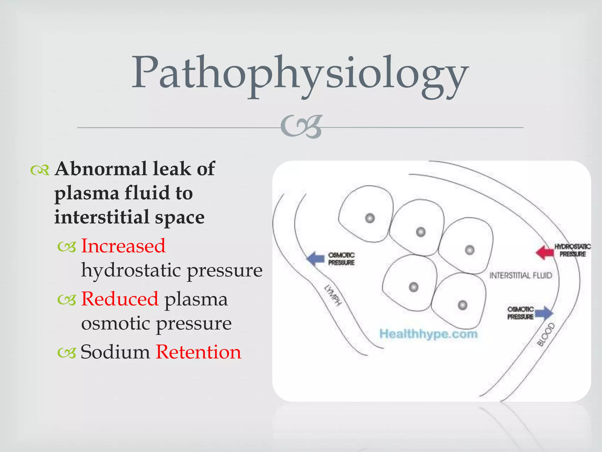 Generalized Anasarca | PPTX