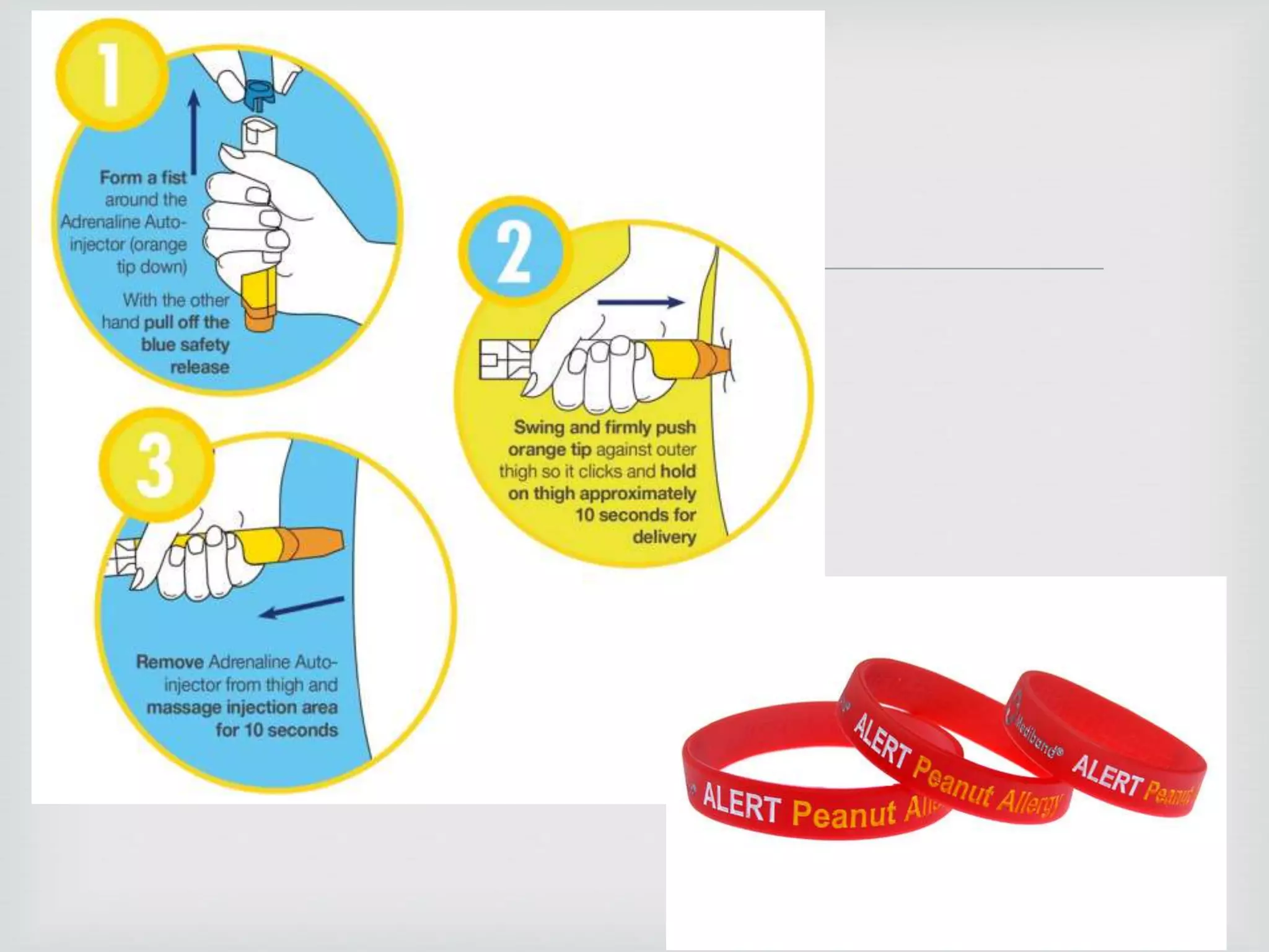 Generalized Anasarca | PPTX