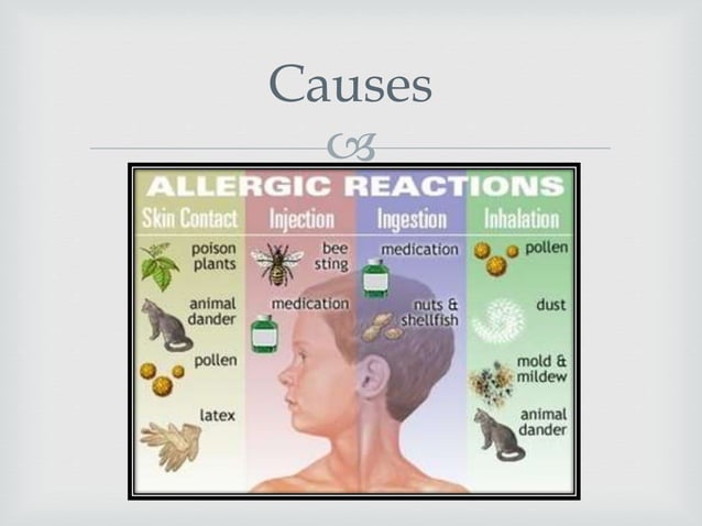 Generalized Anasarca | PPT