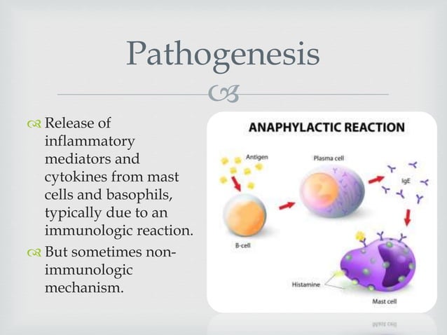 Generalized Anasarca | PPTX
