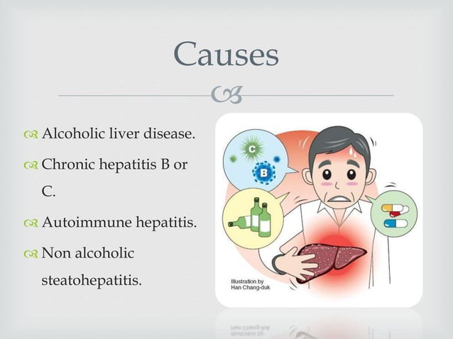 Generalized Anasarca | PPTX