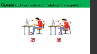 Computer Vision Syndrome | PPTX