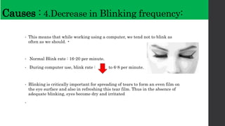 Computer Vision Syndrome | PPTX