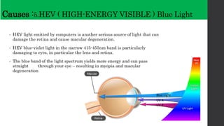 Computer Vision Syndrome | PPTX