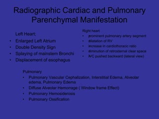 Mitral stenosis | PPTX