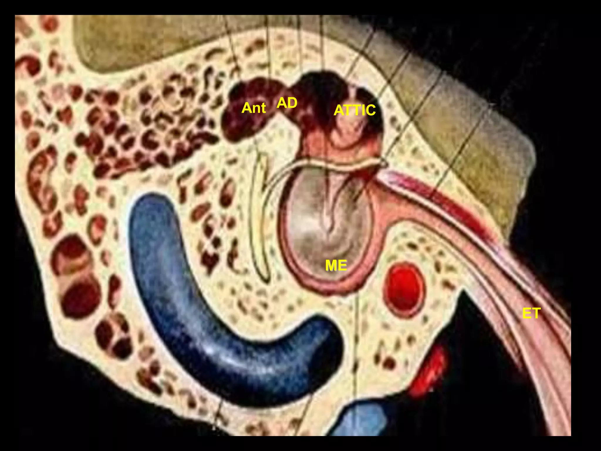 1. anatomy of ear and mastoid | PPT