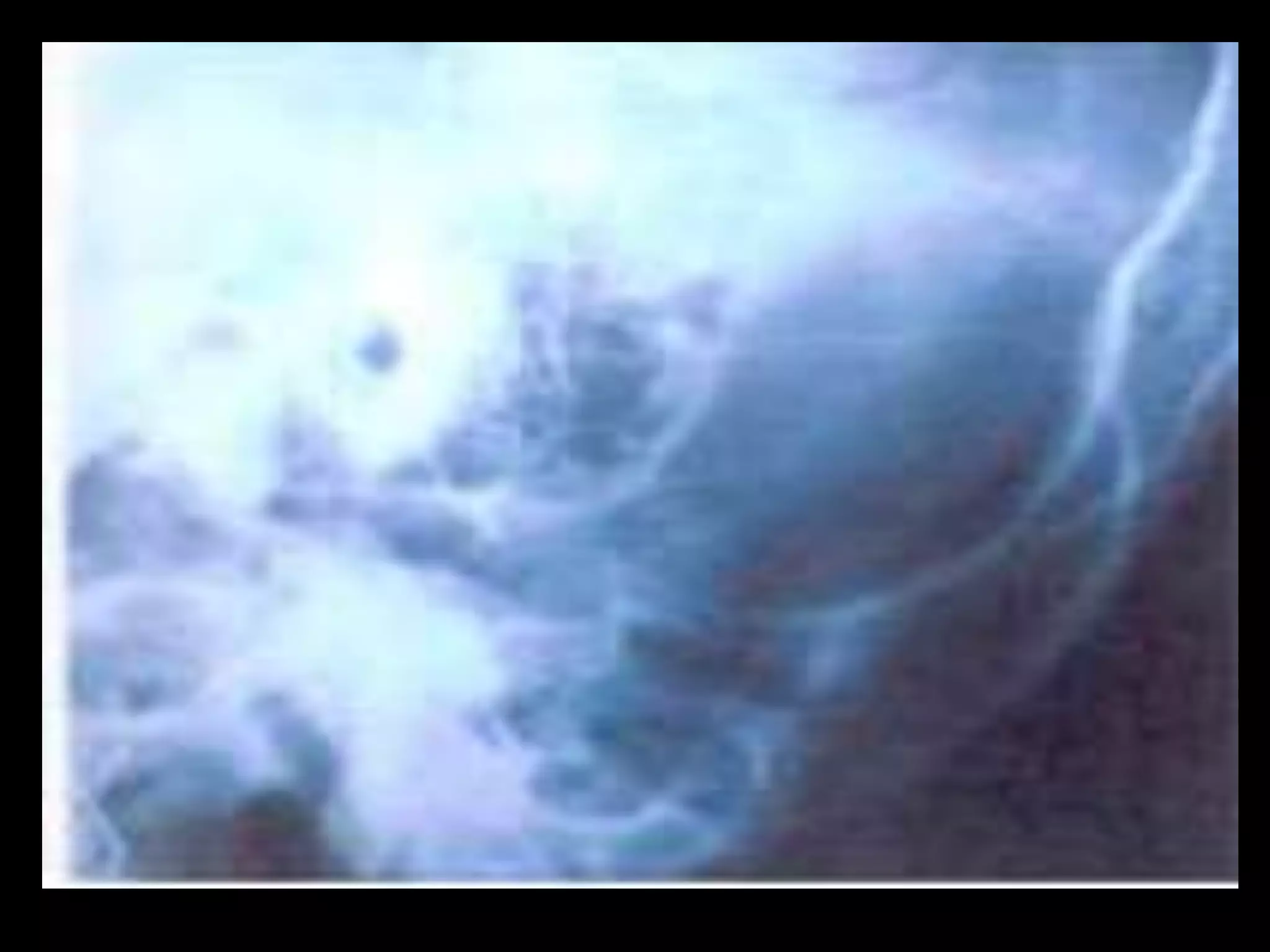 1. anatomy of ear and mastoid | PPT