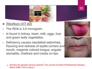 nutrion in edentulous patient and calcium metabolism | PPTX