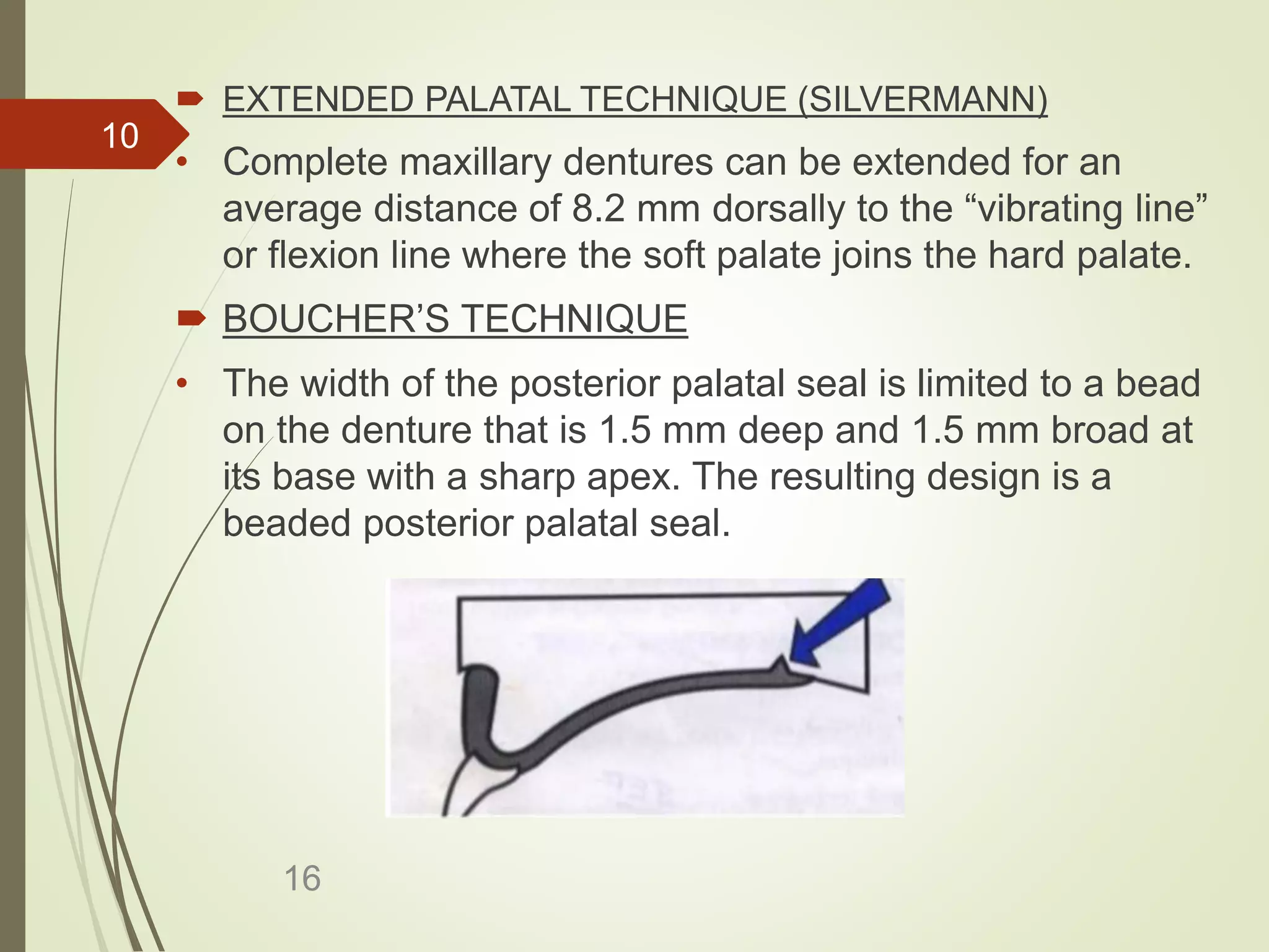 posterior palatal seal | PPTX