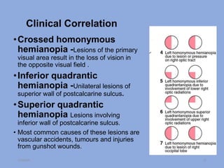 Functional areas of brain | PPTX