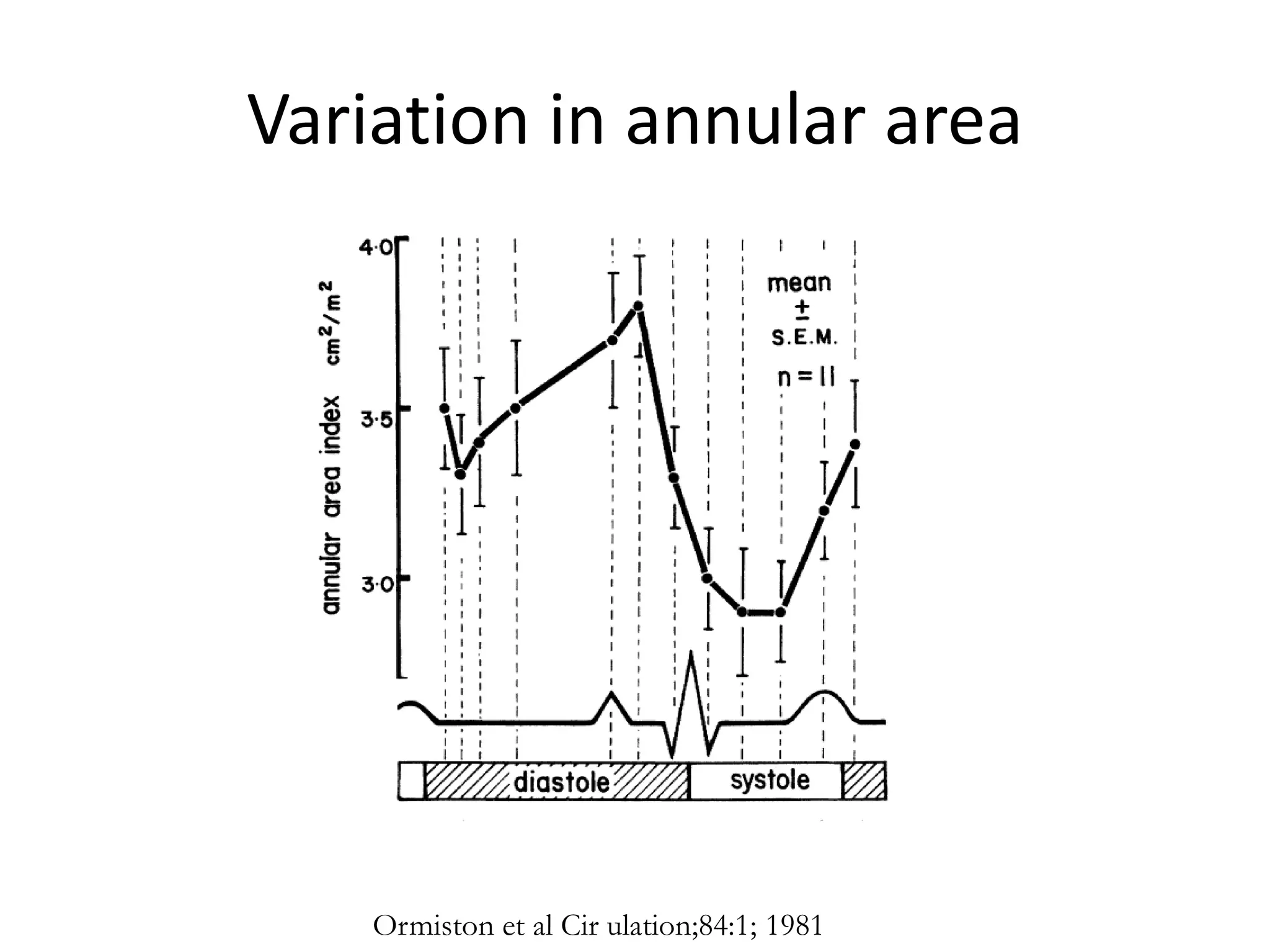 anatomy of mitral valve | PPTX