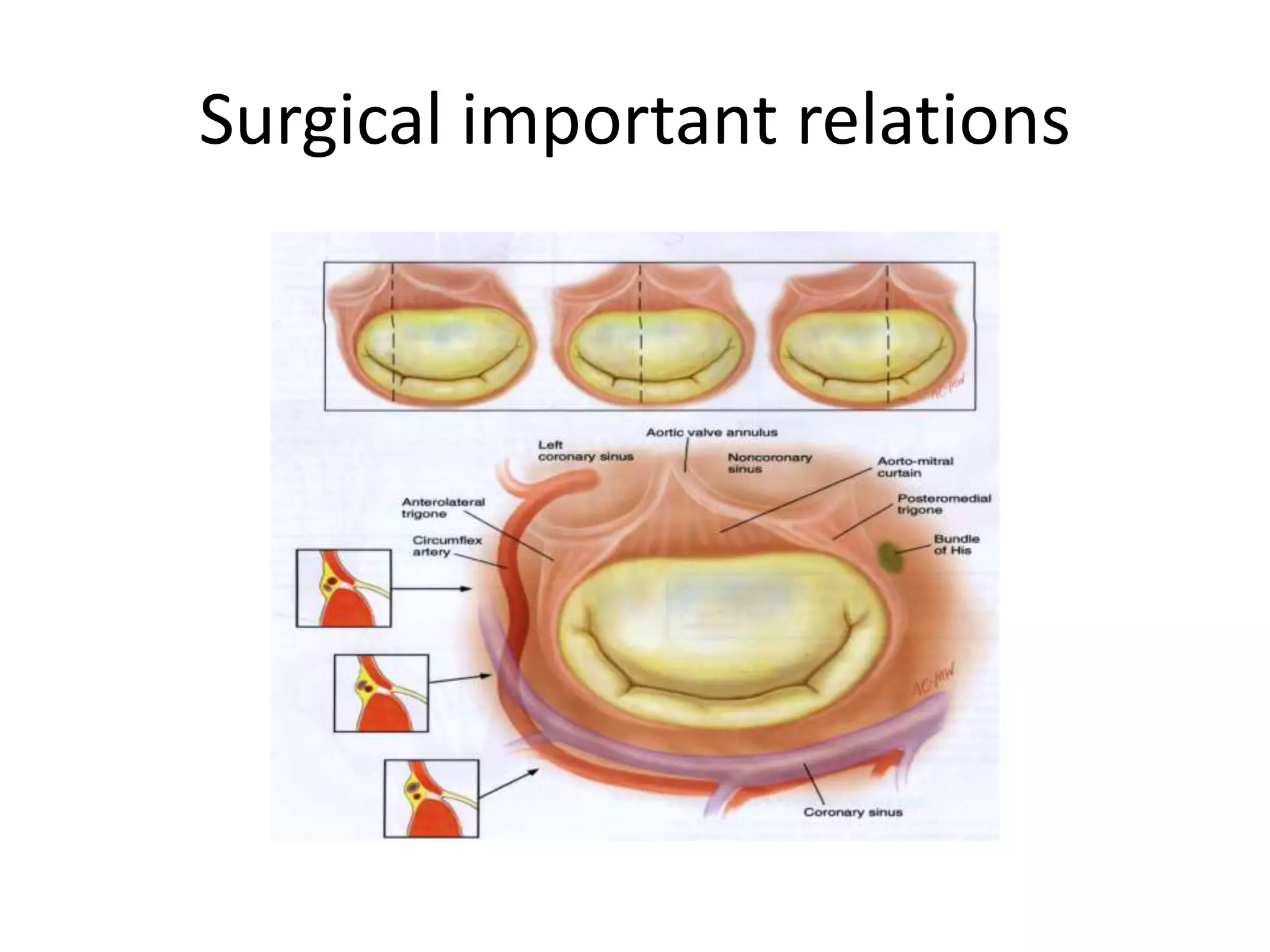 anatomy of mitral valve | PPTX