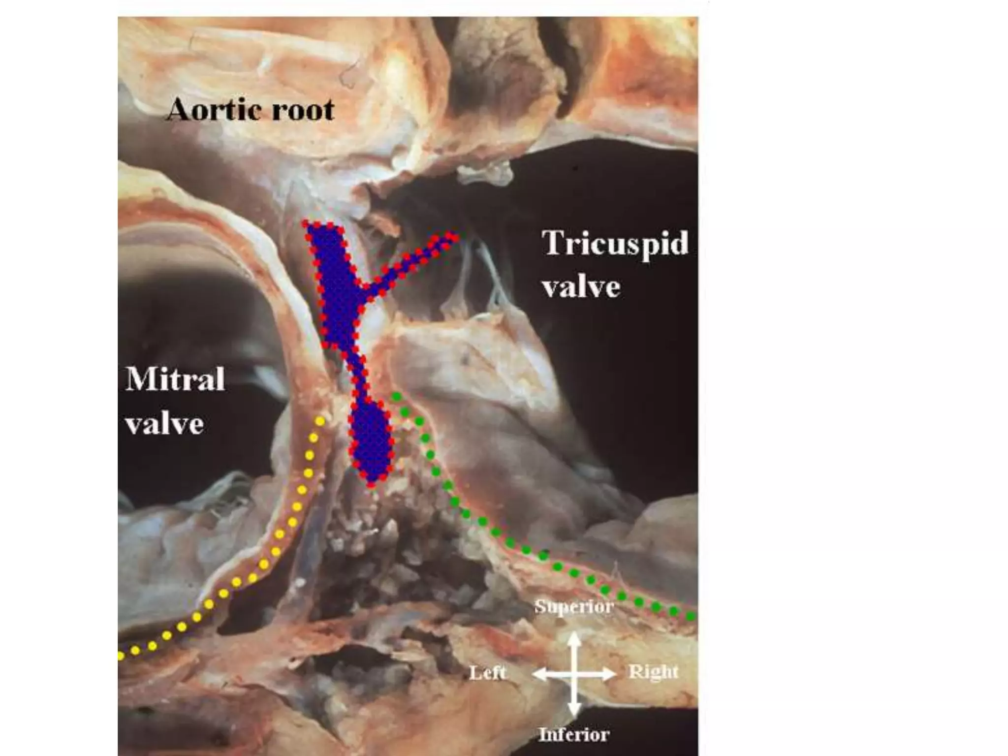 anatomy of mitral valve | PPTX
