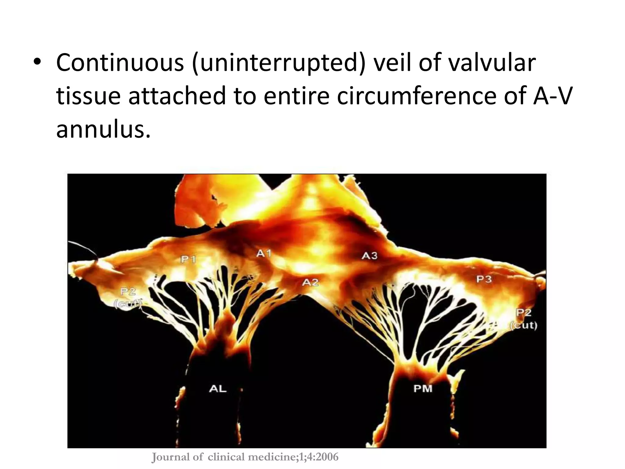 anatomy of mitral valve | PPTX