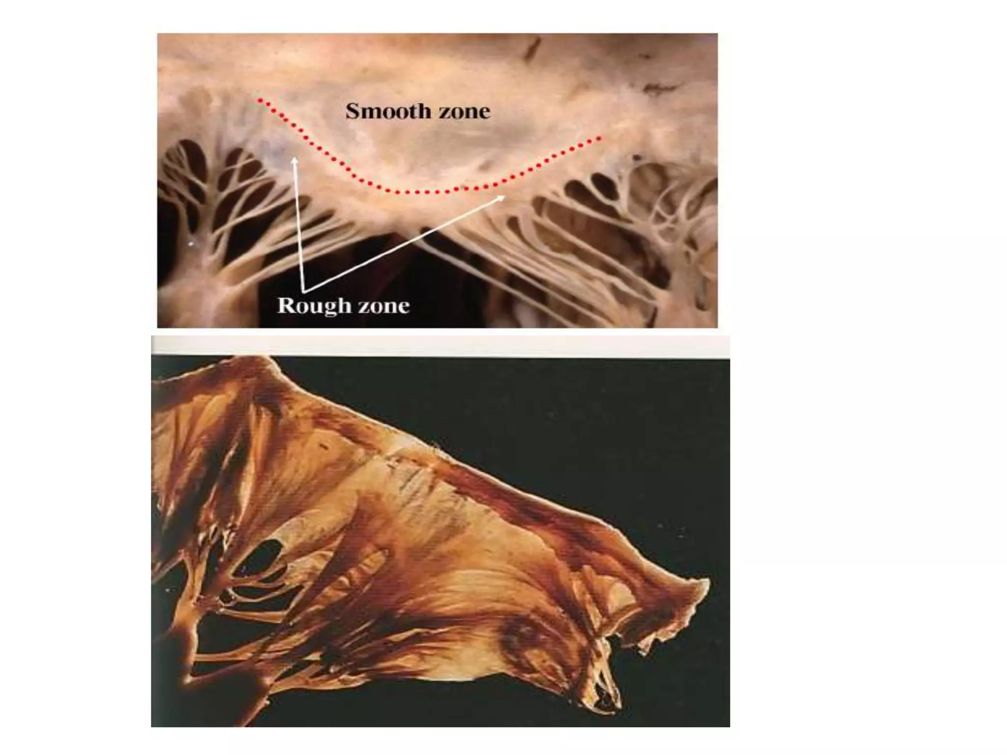 anatomy of mitral valve | PPTX