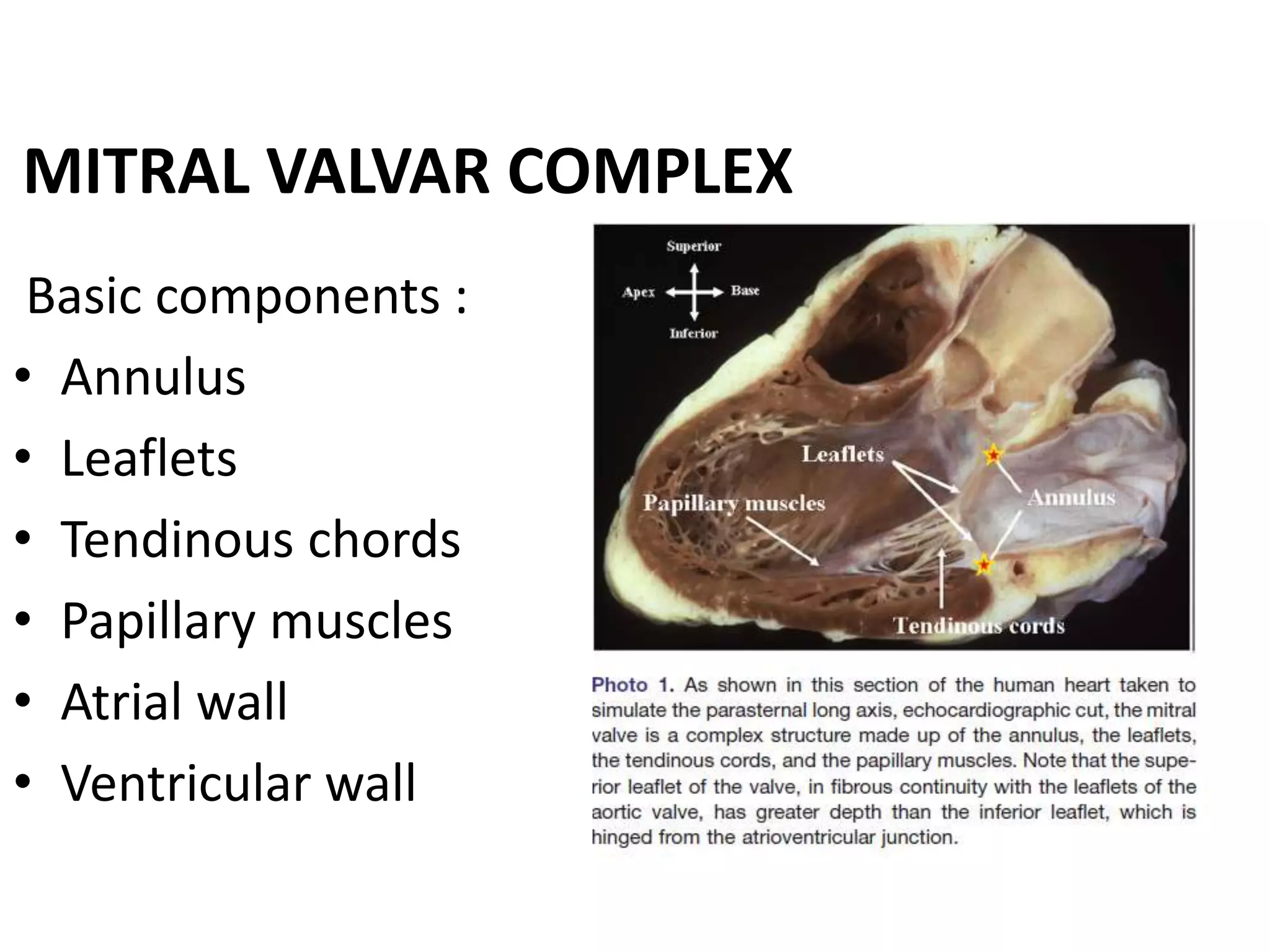anatomy of mitral valve | PPTX