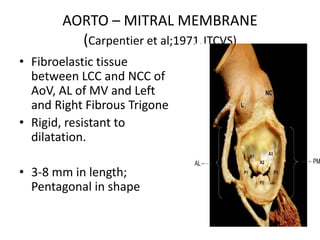anatomy of mitral valve | PPTX