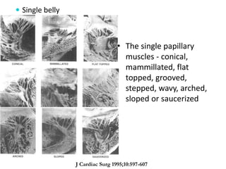 anatomy of mitral valve | PPTX