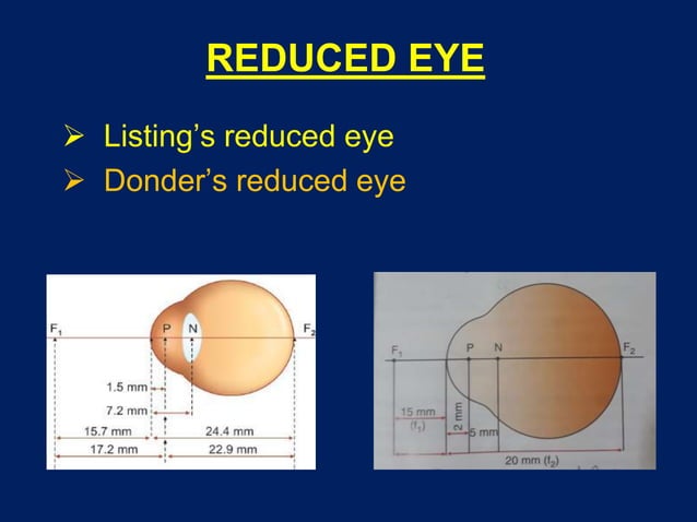 LIGHT, PHYSICAL & PHYSIOLOGICAL OPTICS | PPT