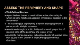 Principles of Radiographic Interpretations | PPTX