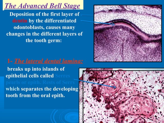 Oral Histology "tooth development"