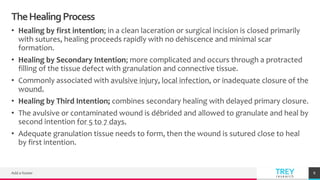 Wound Healing | PPTX